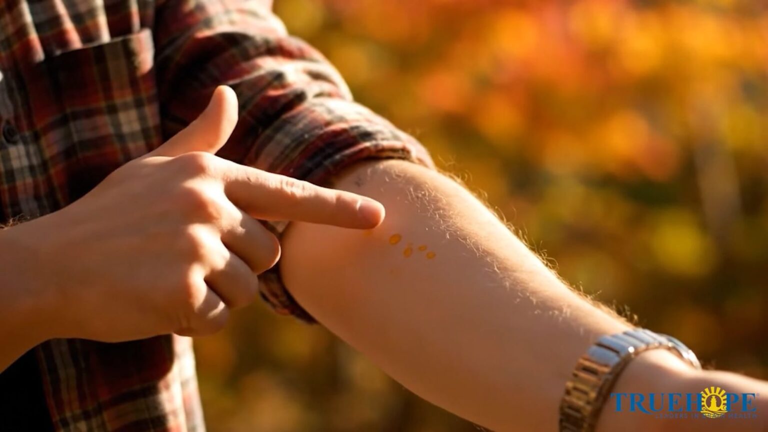 How to Do the Iodine Patch Test (And What The Results Reveal About Your ...